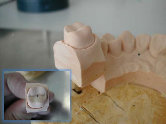 02 02 sectioning a crown model | PPTX