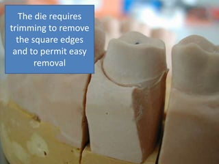 02 02 sectioning a crown model | PPTX