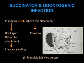 02.space infections clinical features & treatment | PPT