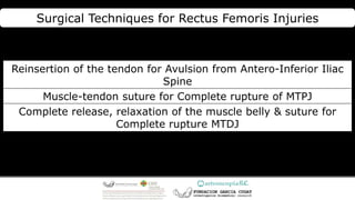 Rectus Femoris Injuries: what and when? Ramon Cugat | PPT