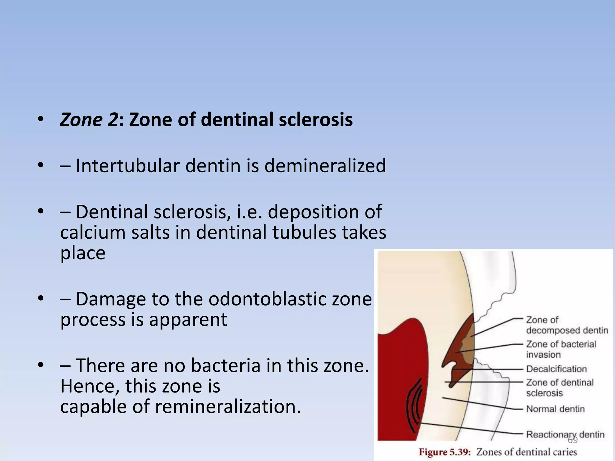 02.dental caries | PPTX