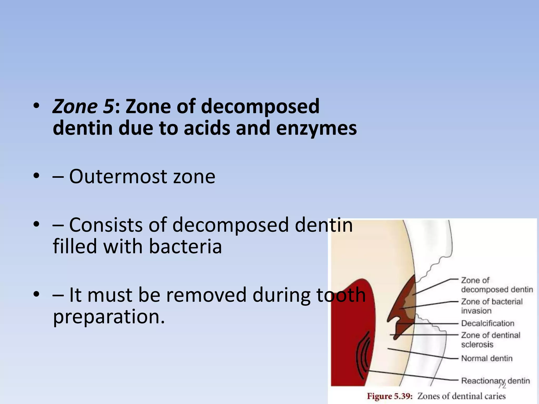 02.dental caries | PPTX