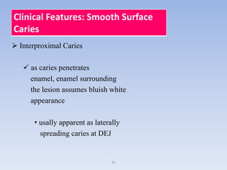 02.dental caries | PPTX