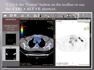 Nuclear Medicine - PET/CT | PPTX
