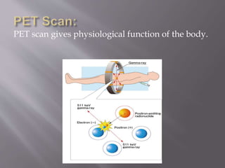 Nuclear Medicine - PET/CT | PPTX
