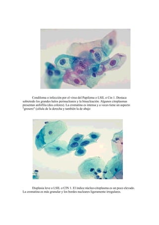 02. introduccion a la citologia cervical | PDF