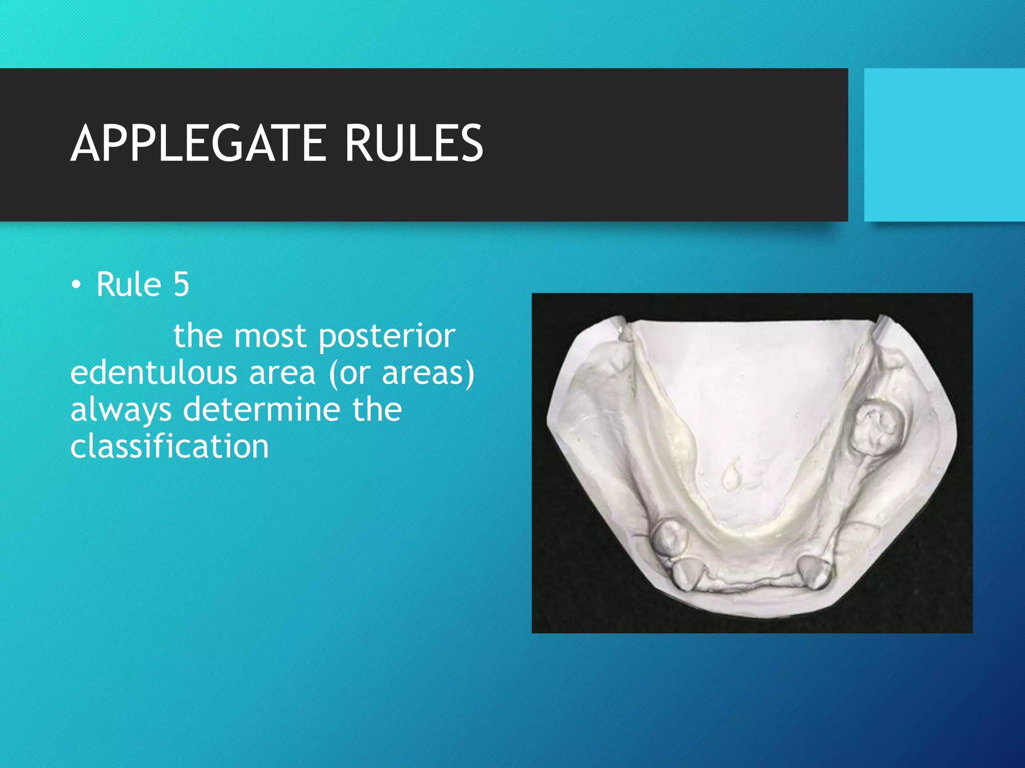 02. kennedy classification | PPTX