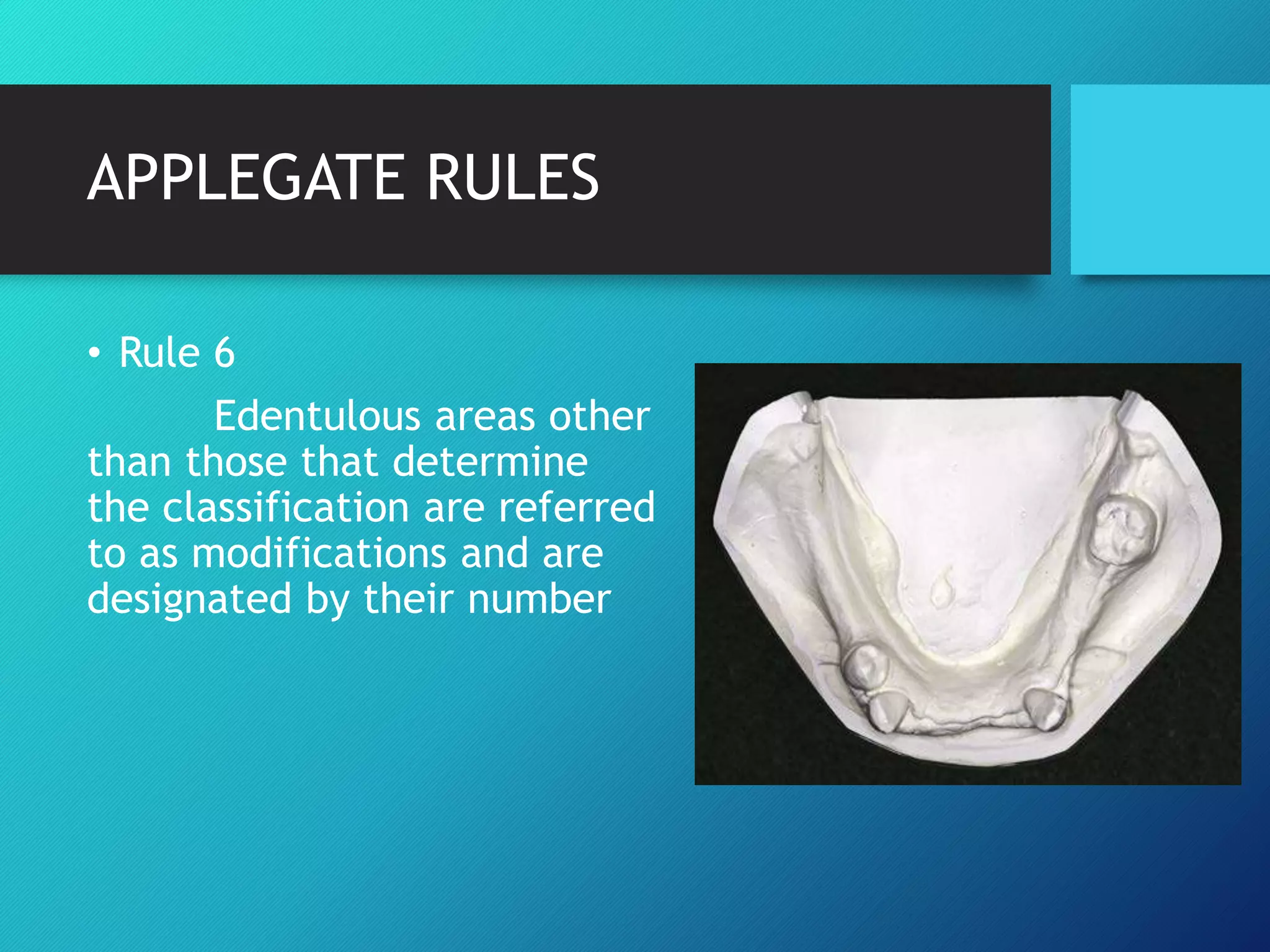02. kennedy classification | PPTX