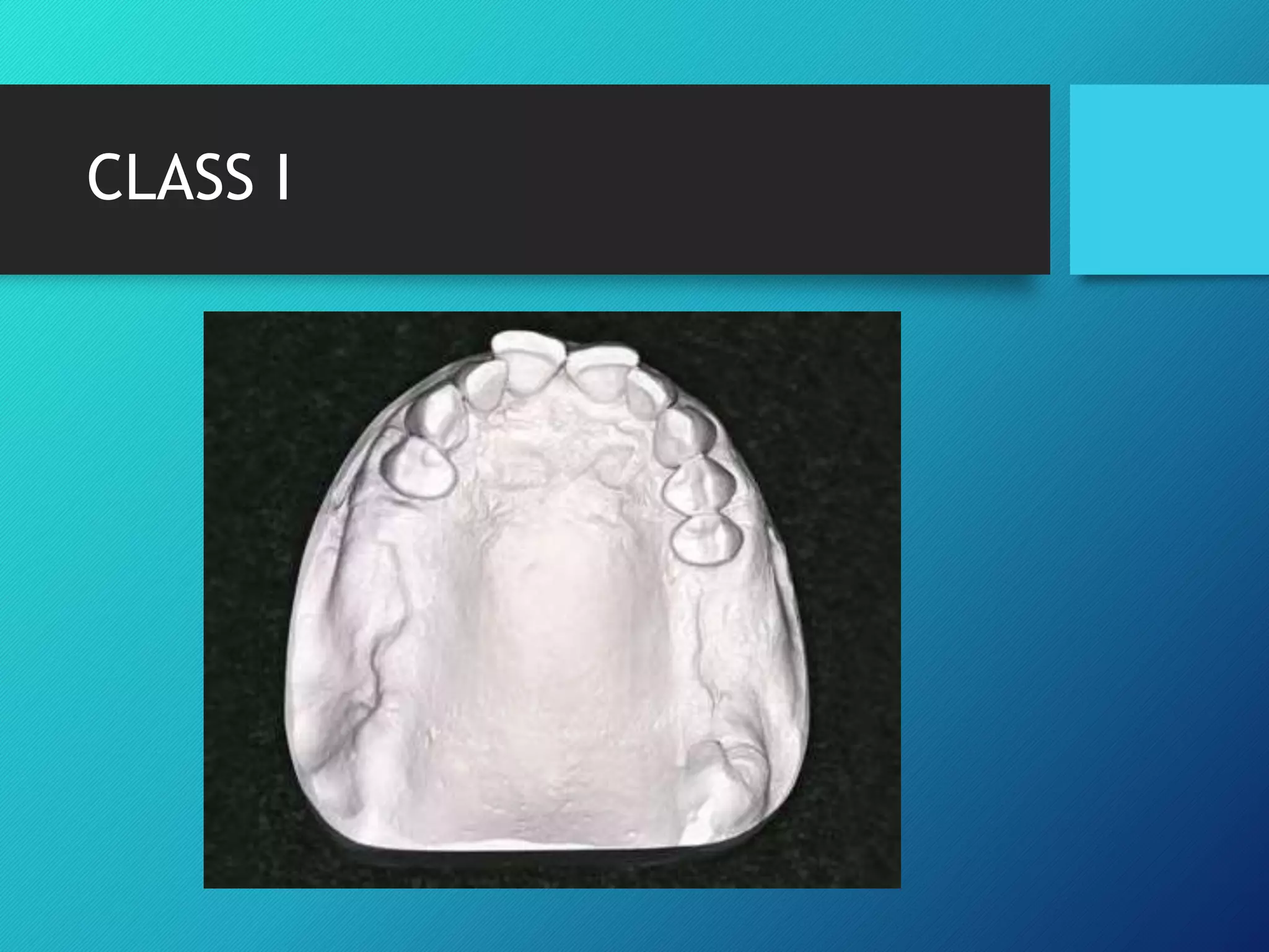 02. kennedy classification | PPTX