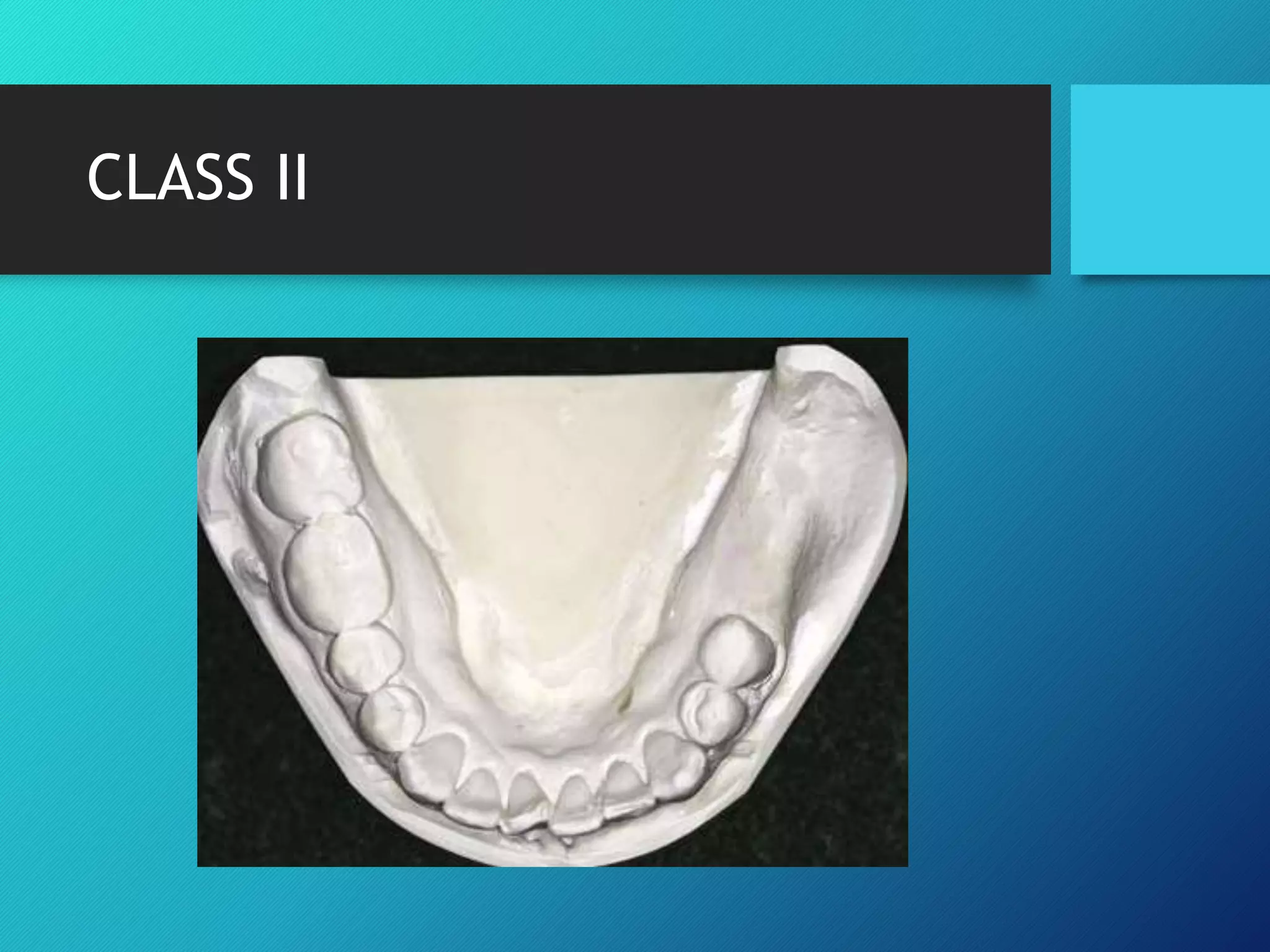 02. kennedy classification | PPTX