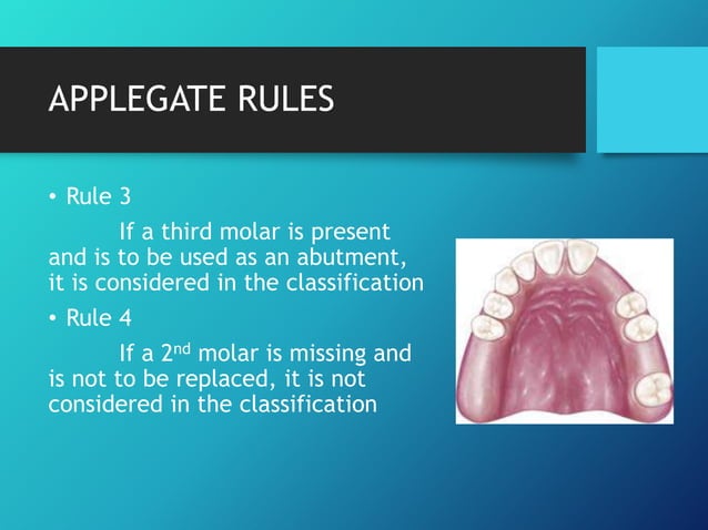 02. kennedy classification | PPTX | Dental Health | Diseases and Conditions