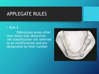 02. kennedy classification | PPTX