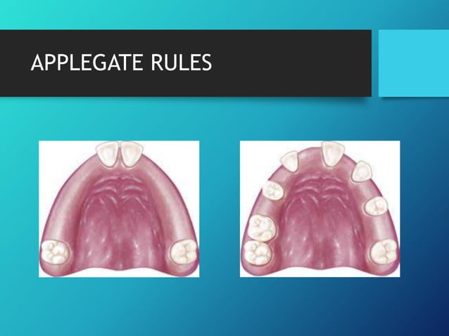 02. kennedy classification | PPTX | Dental Health | Diseases and Conditions