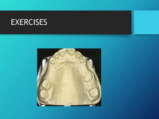 02. kennedy classification | PPTX | Dental Health | Diseases and Conditions
