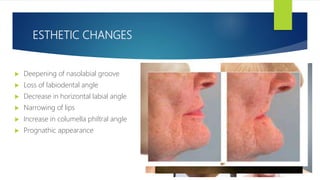 02. edentulous state and health aspect of patients | PPT