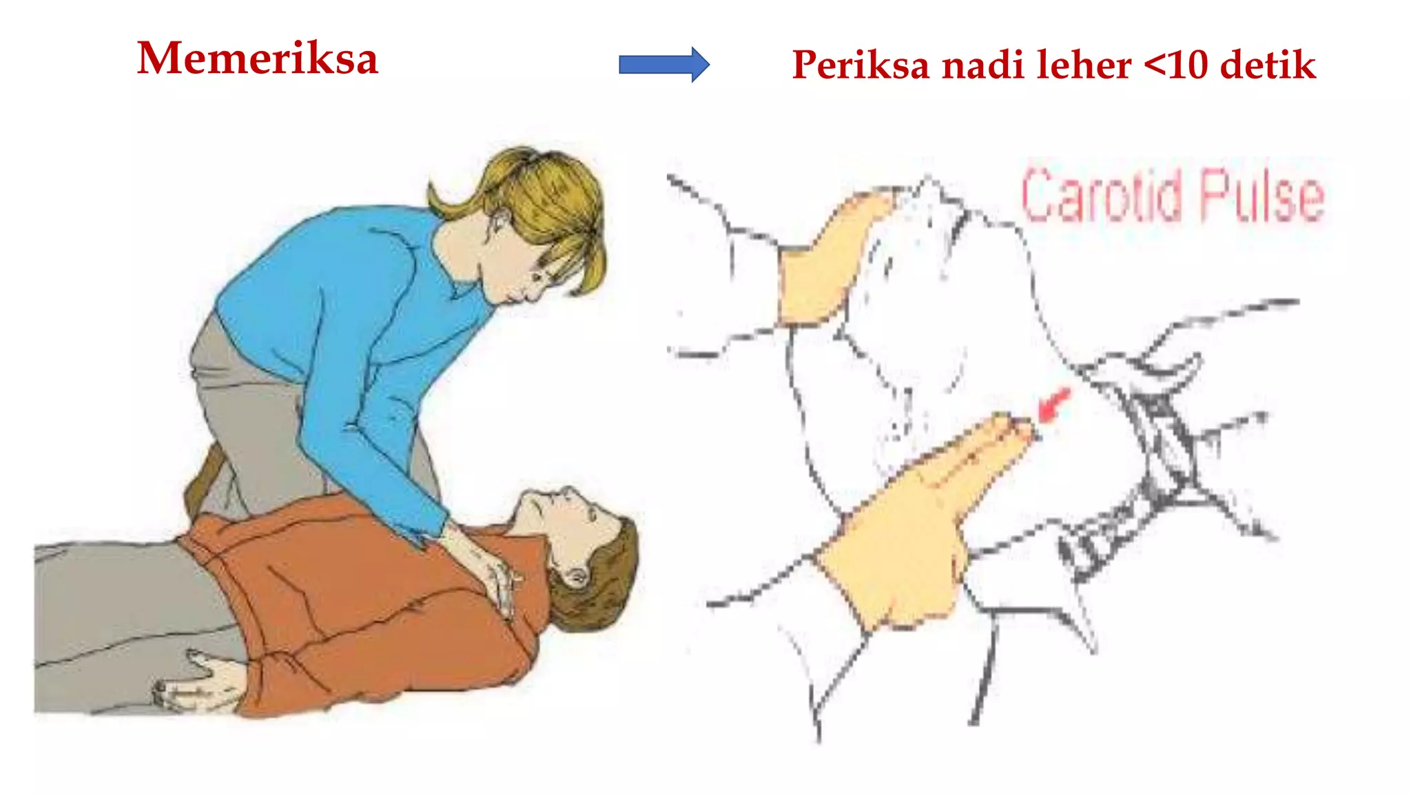 02. bantuan hidup dasar ns 2020 revisi | PPTX