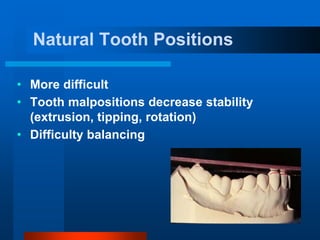 02. Single Complete Denture.pptx