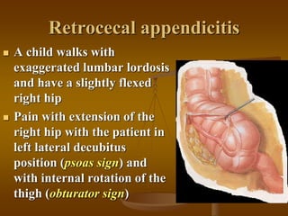02. Purulent-inflammatory diseases of abdominal cavity ...