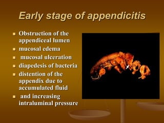02. Purulent-inflammatory diseases of abdominal cavity ...