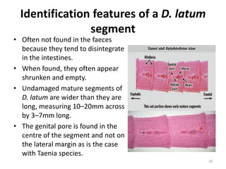 D. Latum tapeworm that can infect humans and | PDF