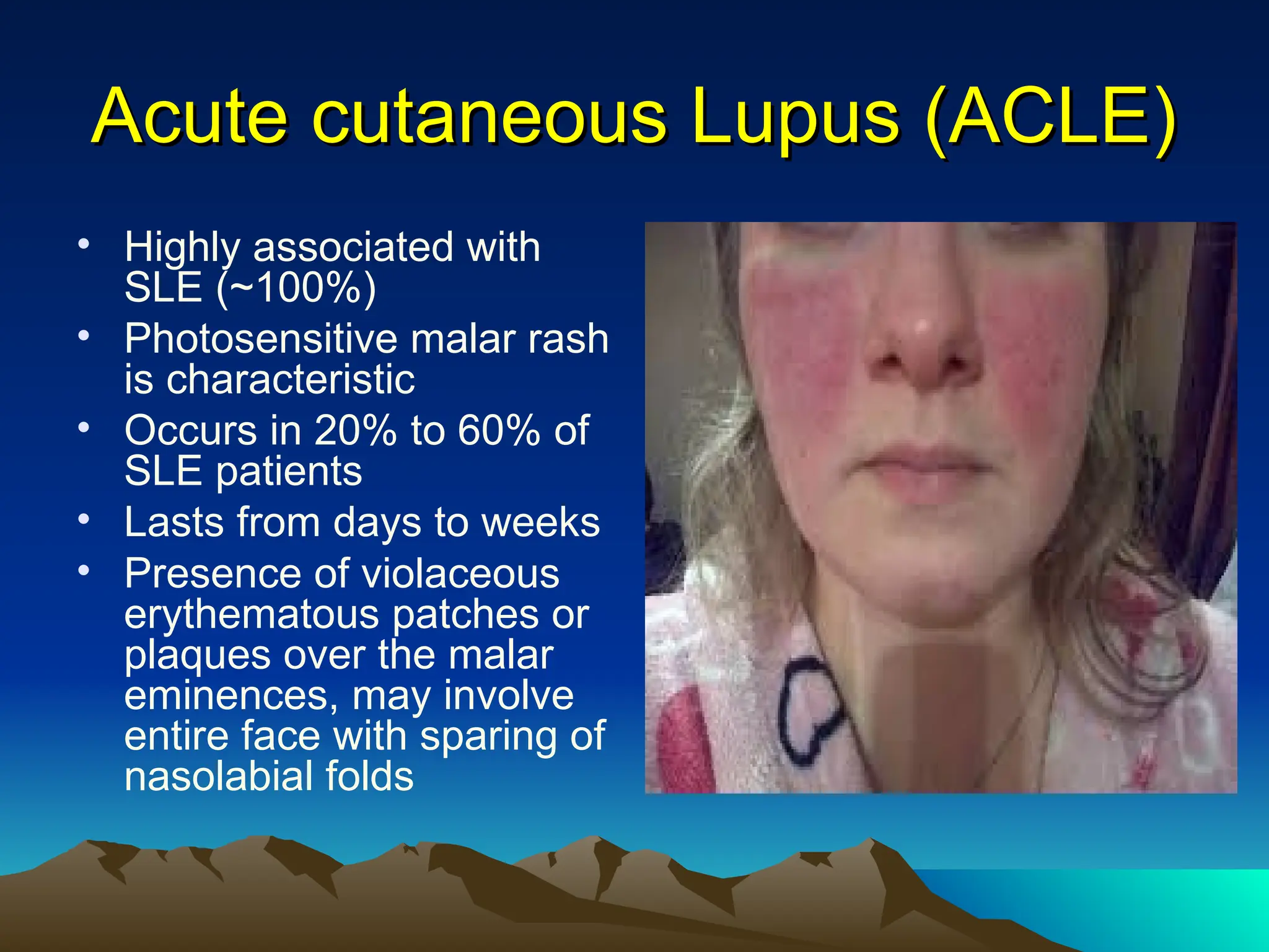 02. Lupus Erythematosus-1. dermatological condition | PPT