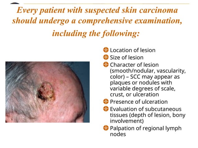 Skin cancer and malignant melanoma management | PPT