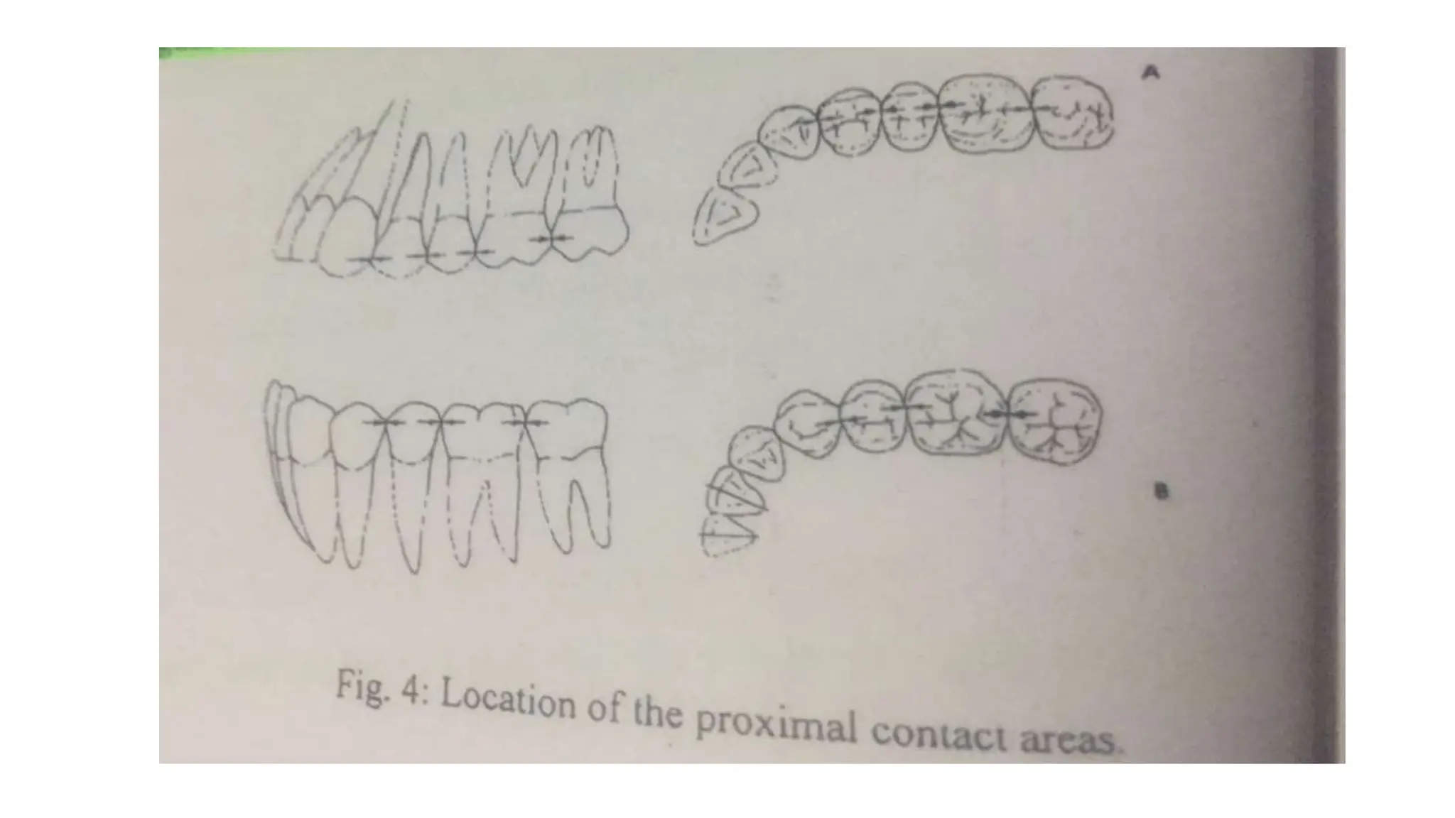 02 - Biological and Periodontal Considerations in Fixed Prosthodontics.pptx