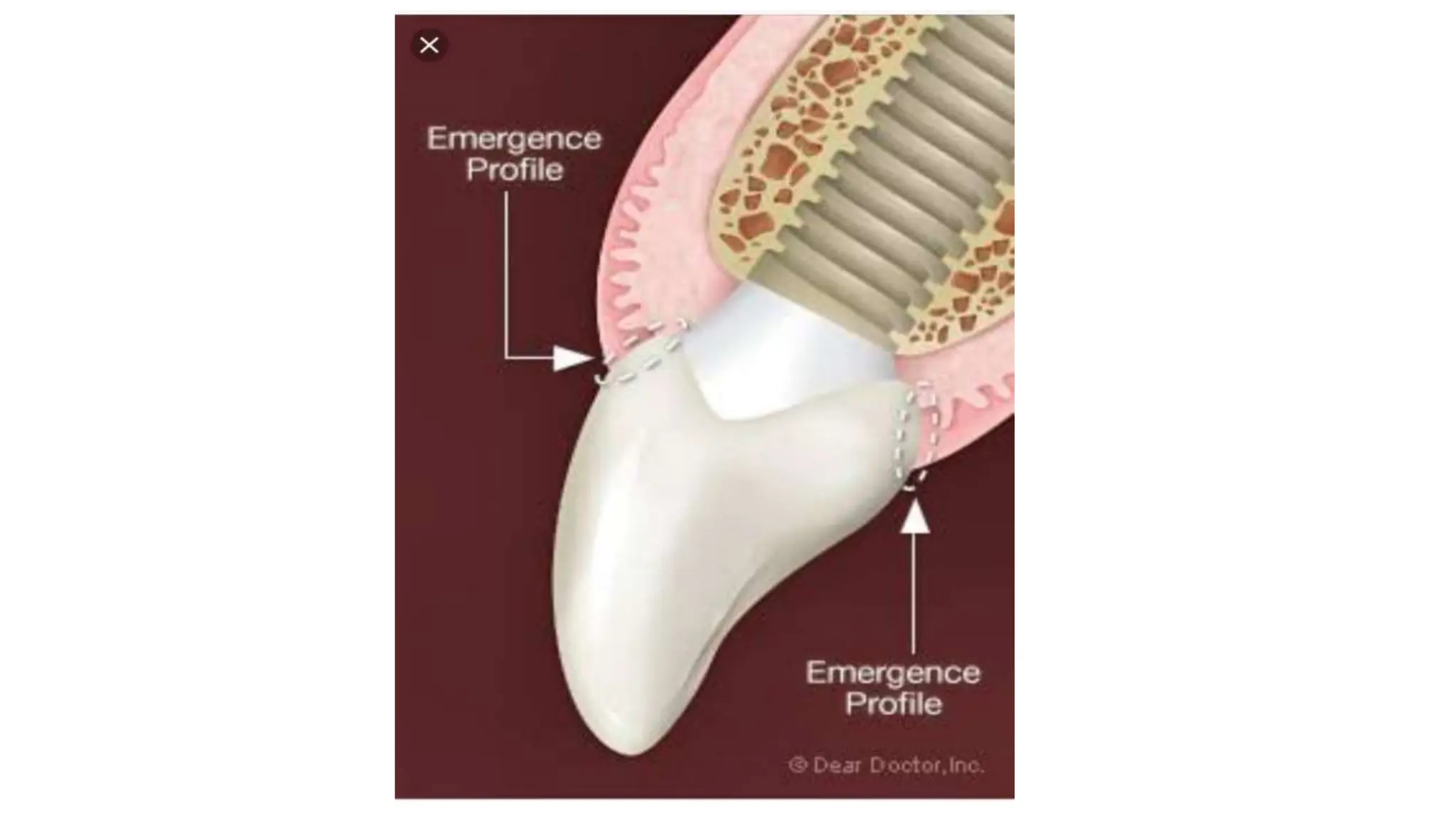 02 - Biological and Periodontal Considerations in Fixed Prosthodontics.pptx