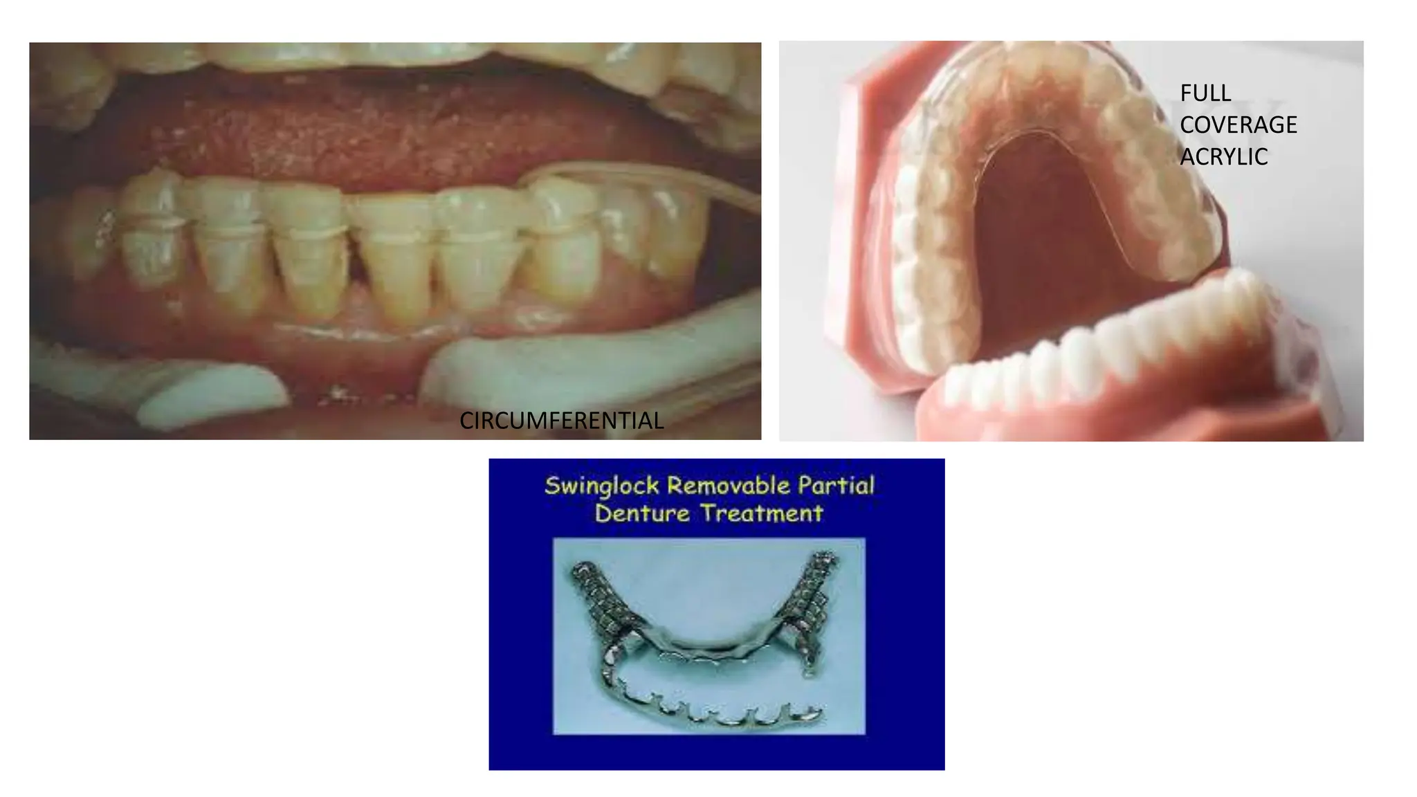 02 - Biological and Periodontal Considerations in Fixed Prosthodontics.pptx