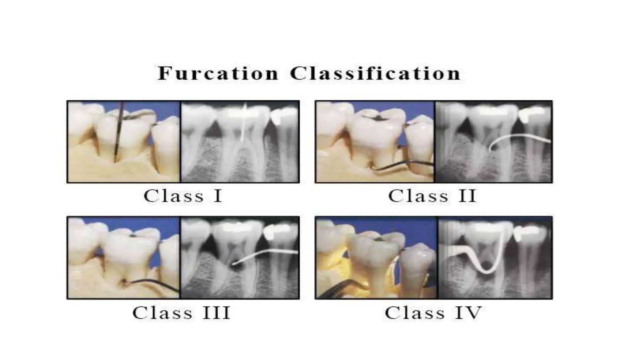 02 - Biological and Periodontal Considerations in Fixed Prosthodontics.pptx