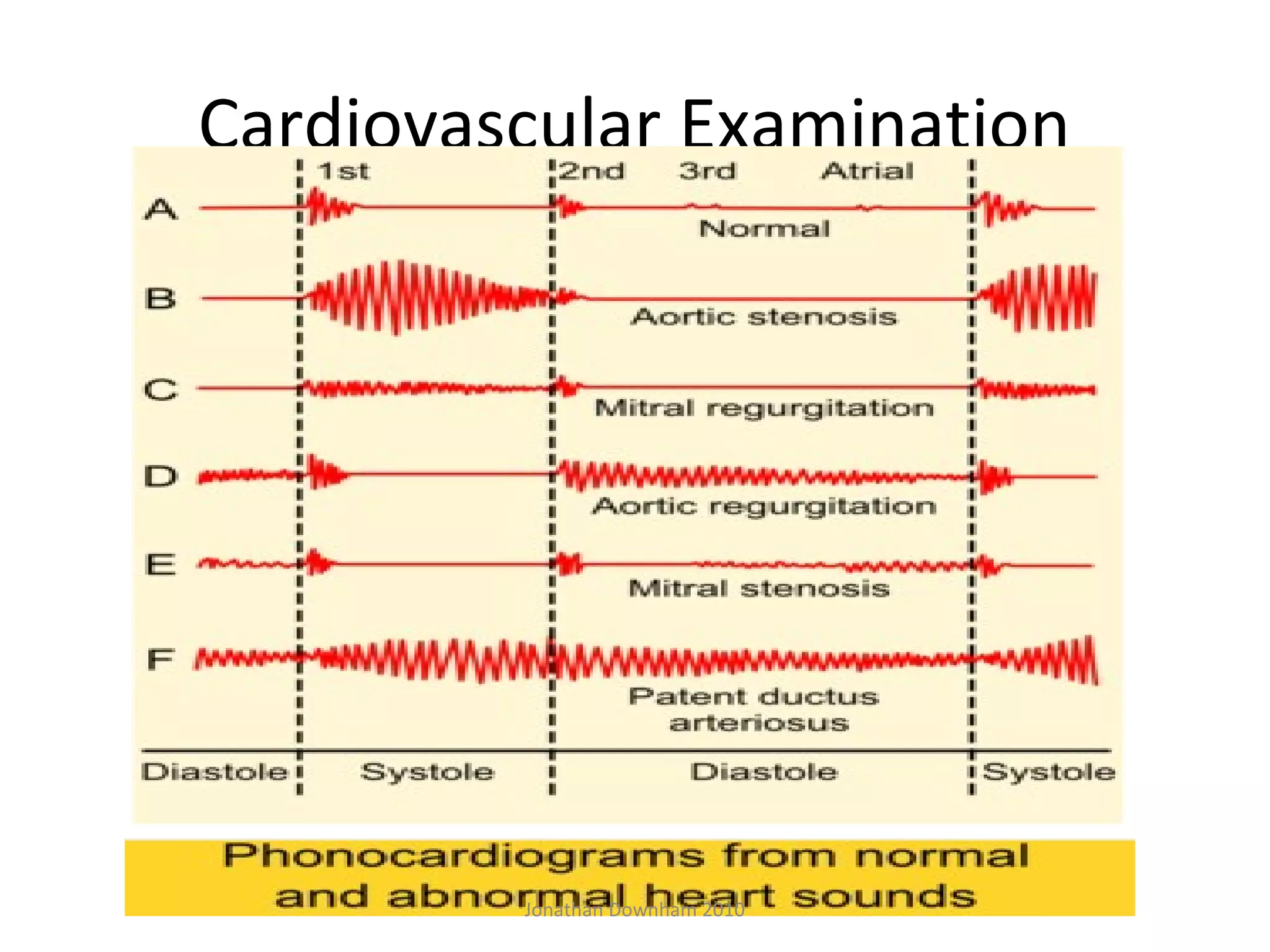 Cardiovascular examination | PPTX