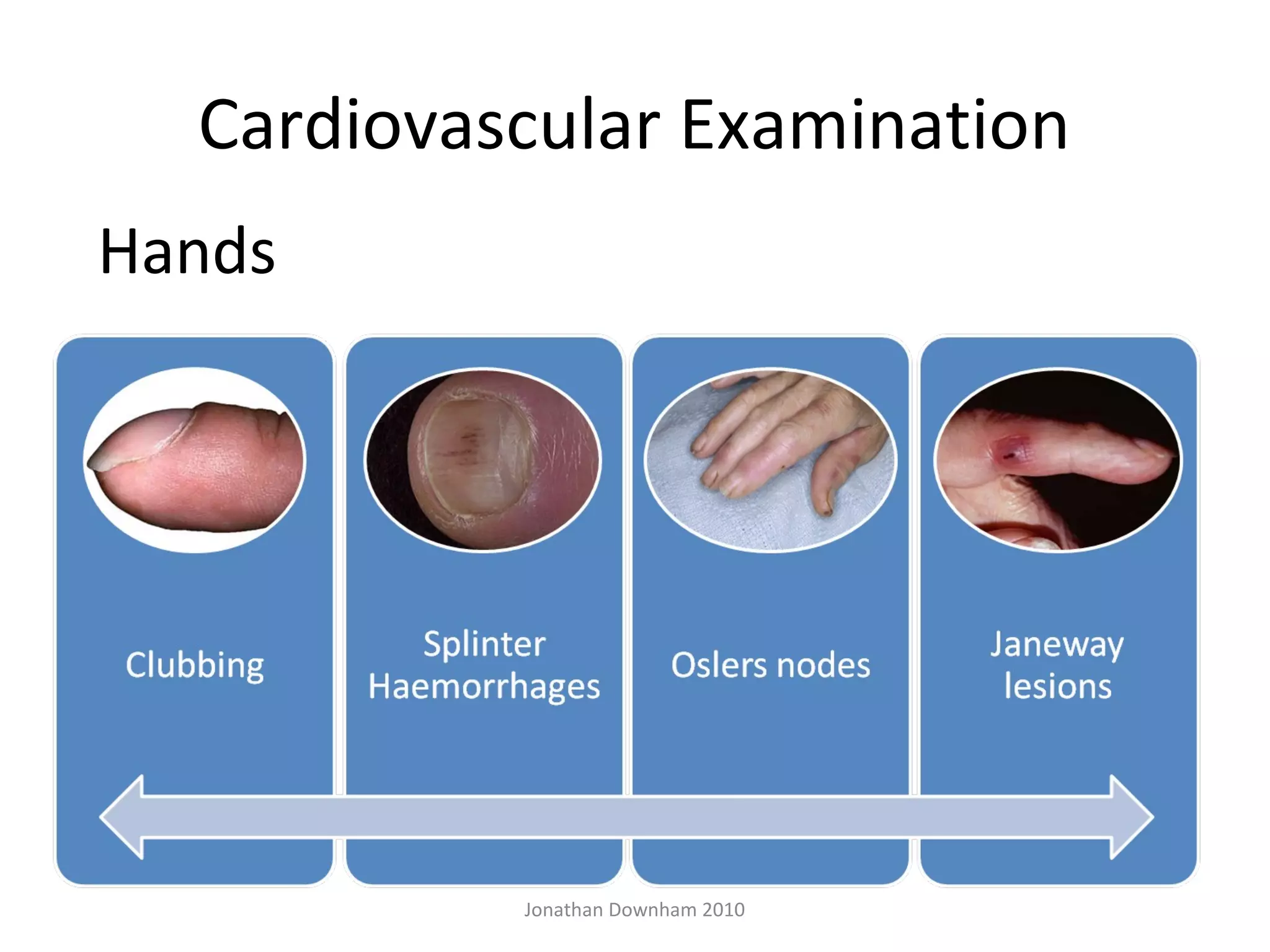 Cardiovascular examination | PPTX