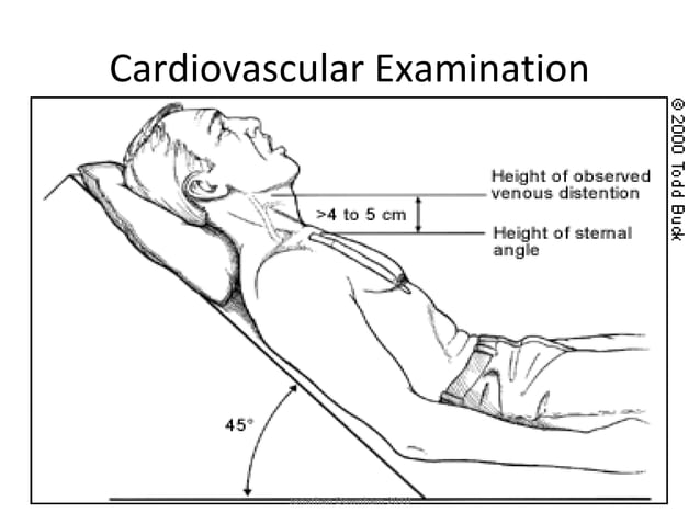 Cardiovascular examination | PPTX | Heart and Cardiovascular Diseases ...