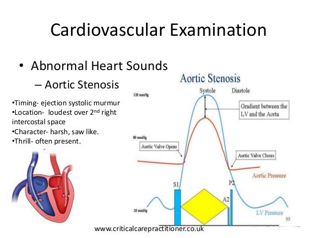 The Physical Examination In Cardiovascular Disease The