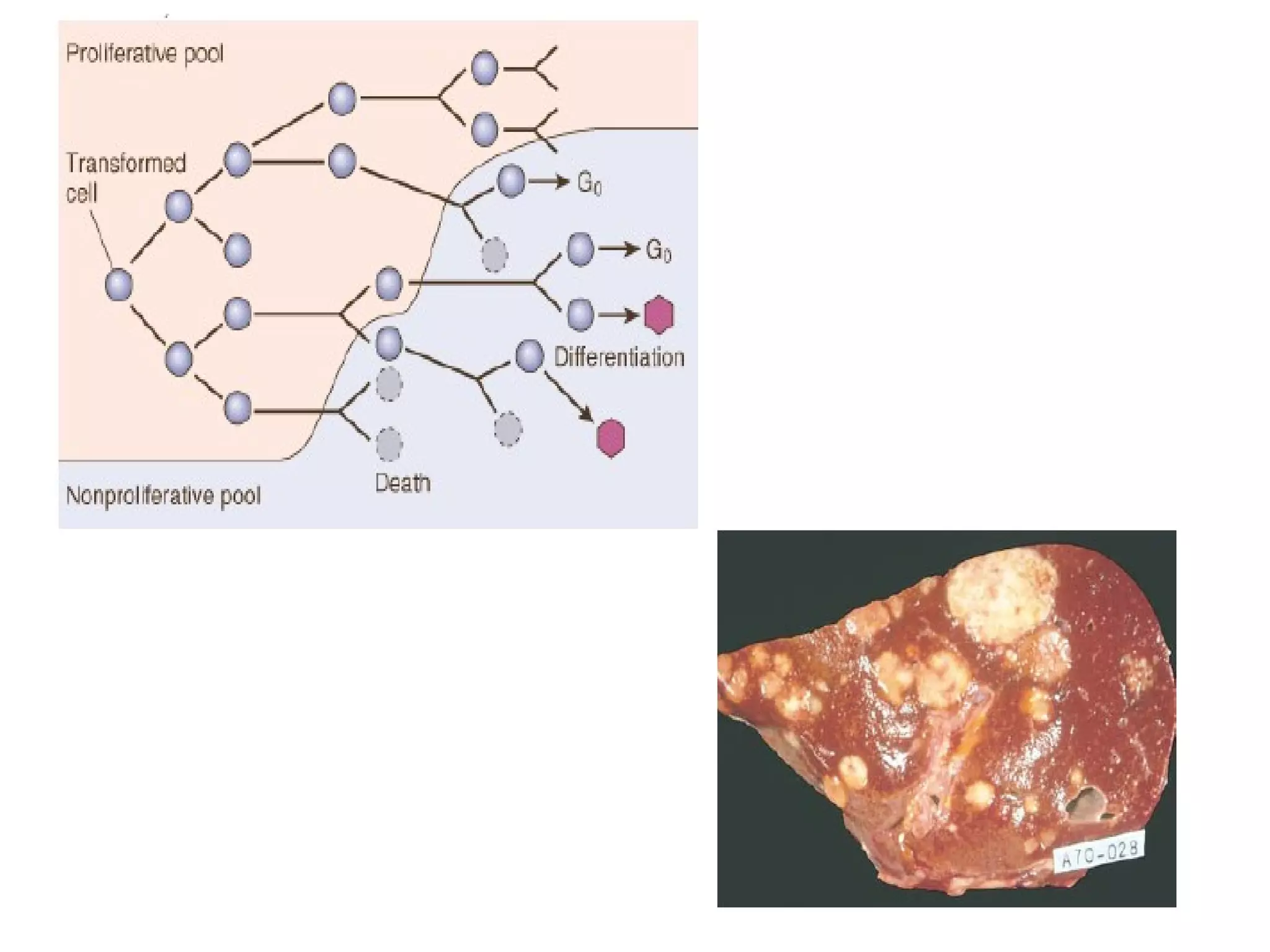 02 Cat. Neoplasia | PPT | Cancer | Diseases and Conditions