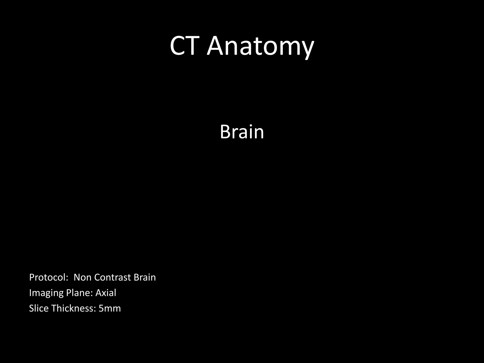 02-CT Brain - Axial anatomy radiology.pdf