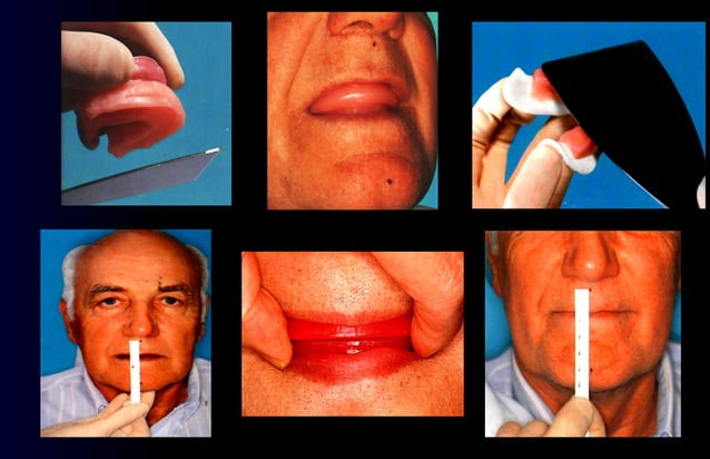02- Definitions (Occlusion in prosthodontics) .pptx