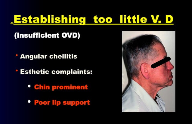 02- Definitions (Occlusion in prosthodontics) .pptx