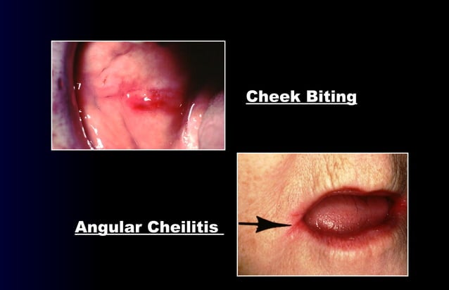 02- Definitions (Occlusion in prosthodontics) .pptx