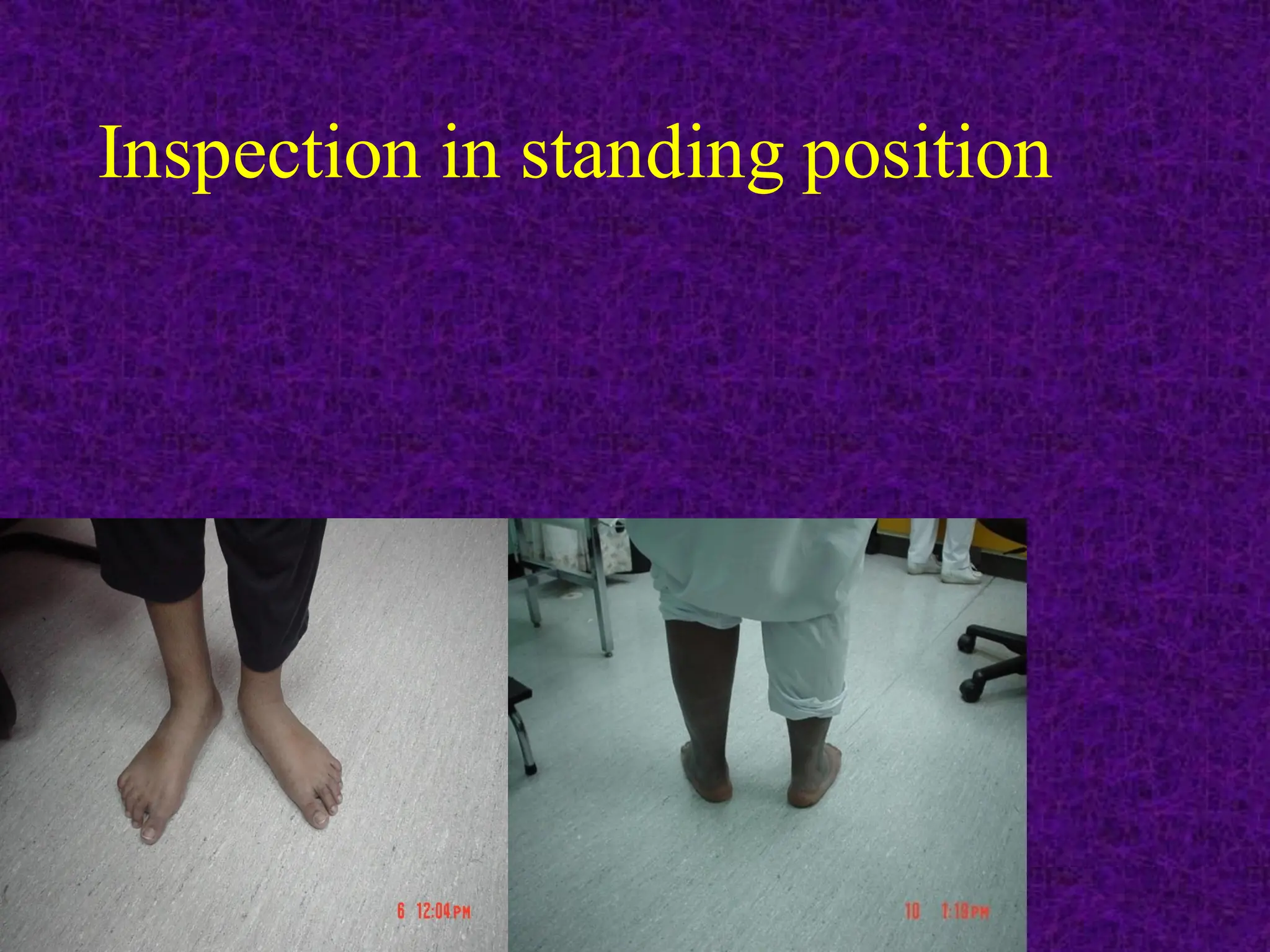 02- EXAMINATION OF THE FOOT AND ANKLE1.pdf