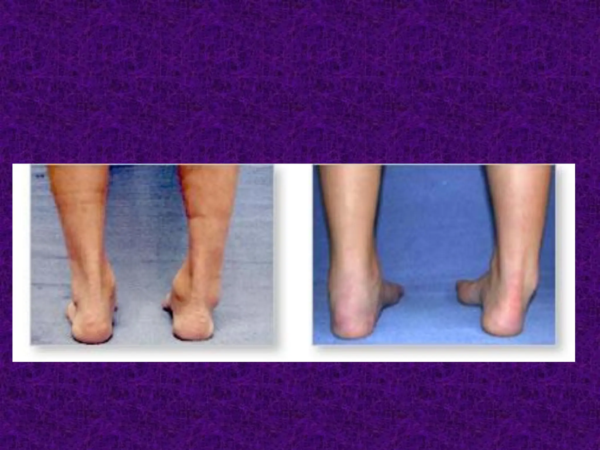 02- EXAMINATION OF THE FOOT AND ANKLE1.pdf