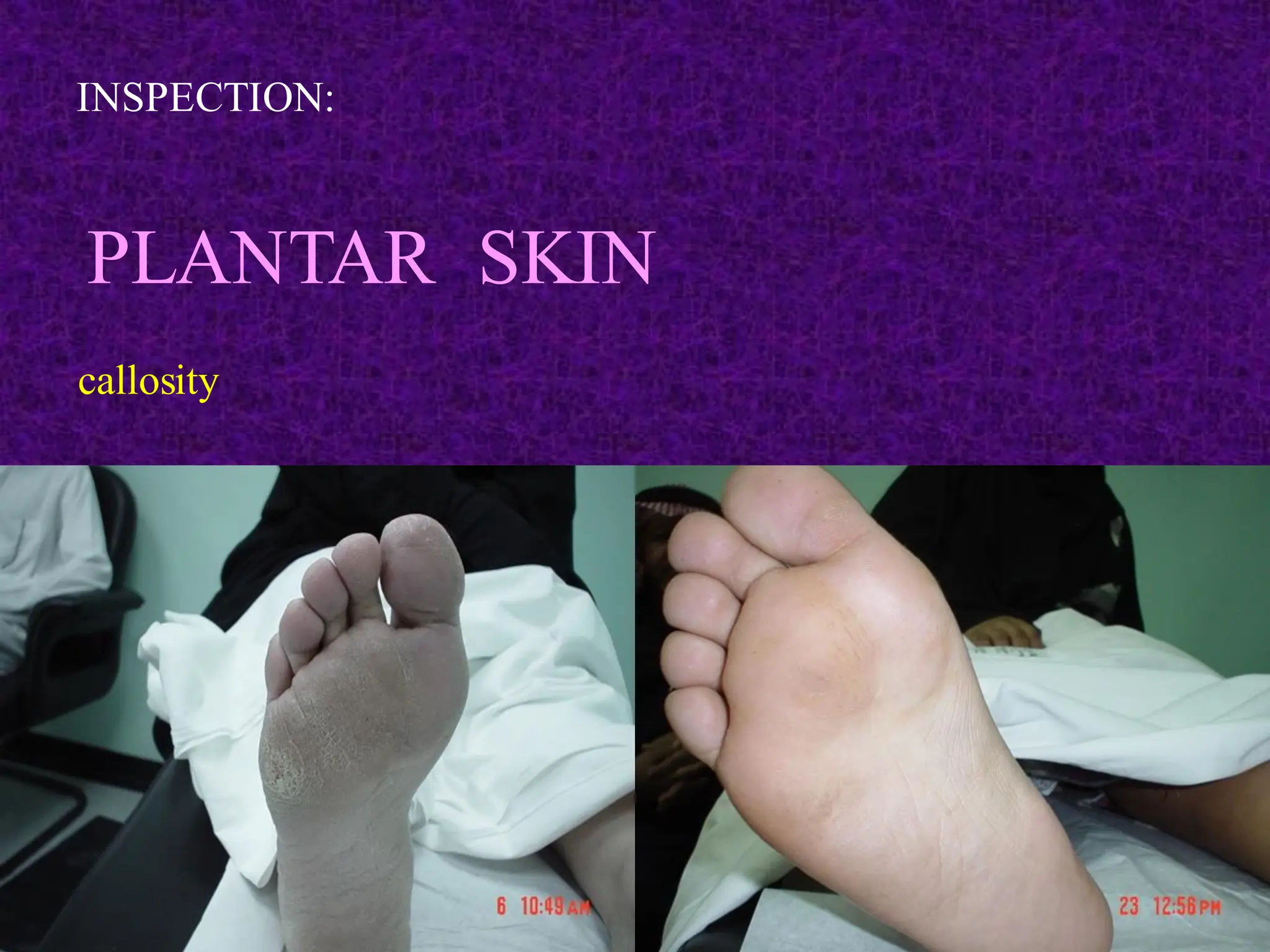 02- EXAMINATION OF THE FOOT AND ANKLE1.pdf