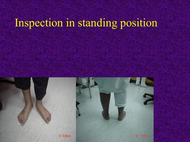 02- EXAMINATION OF THE FOOT AND ANKLE1.pdf