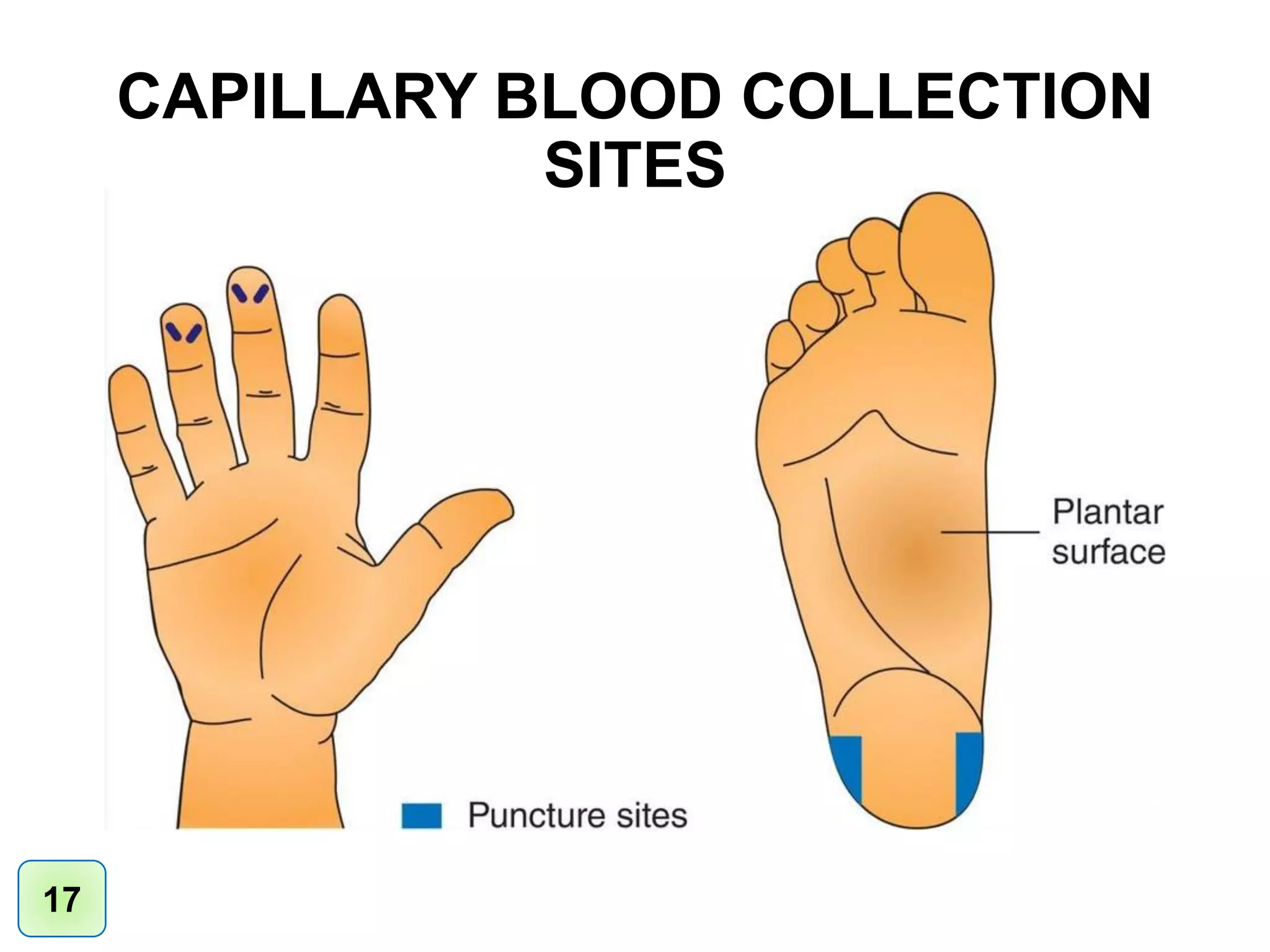 Blood sample collection | PDF