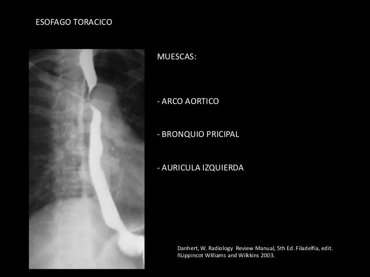 Imagenología de Esofago