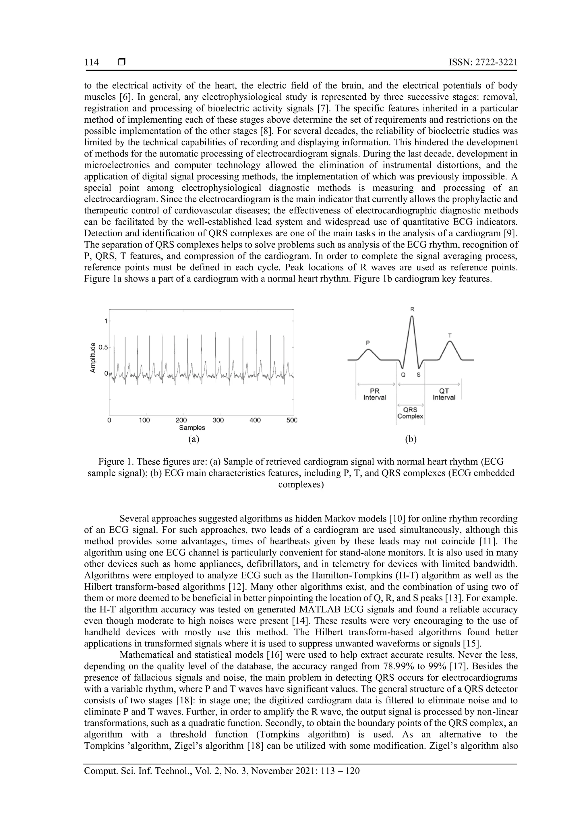 Less Computational Approach To Detect Qrs Complexes In Ecg Rhythms Pdf