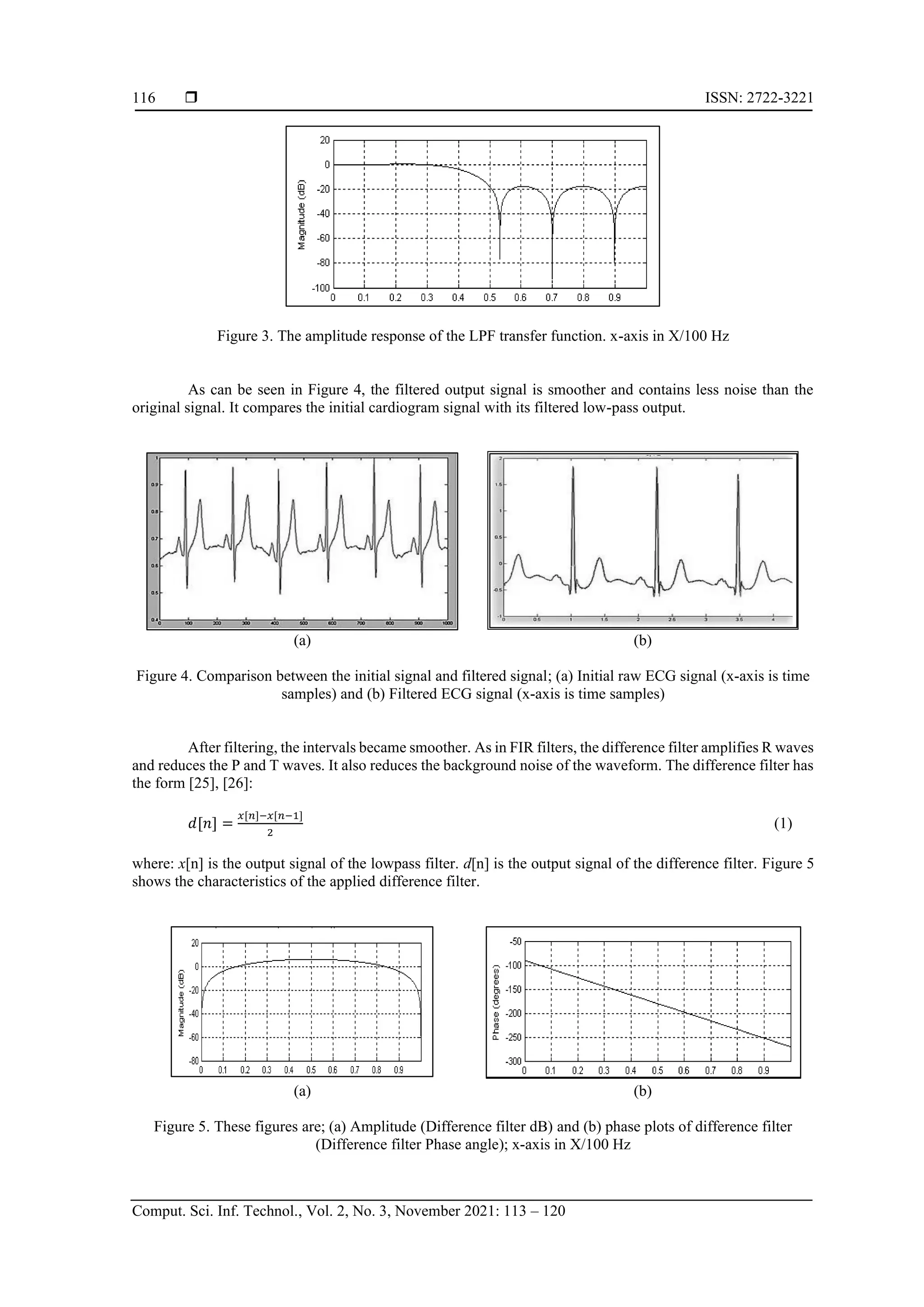 Less Computational Approach To Detect Qrs Complexes In Ecg Rhythms Pdf