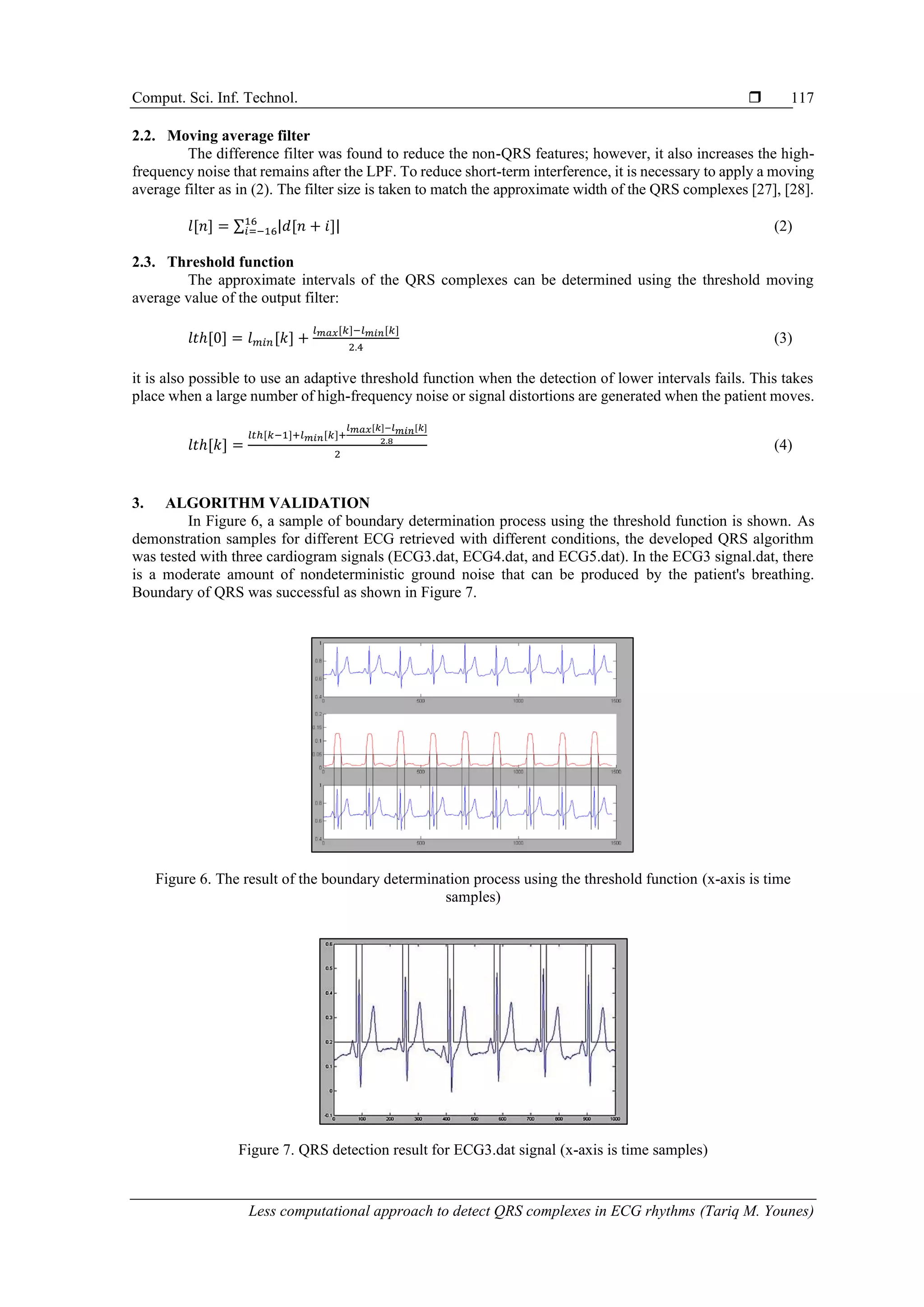 Less computational approach to detect QRS complexes in ECG rhythms | PDF