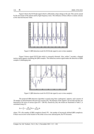 Less computational approach to detect QRS complexes in ECG rhythms | PDF