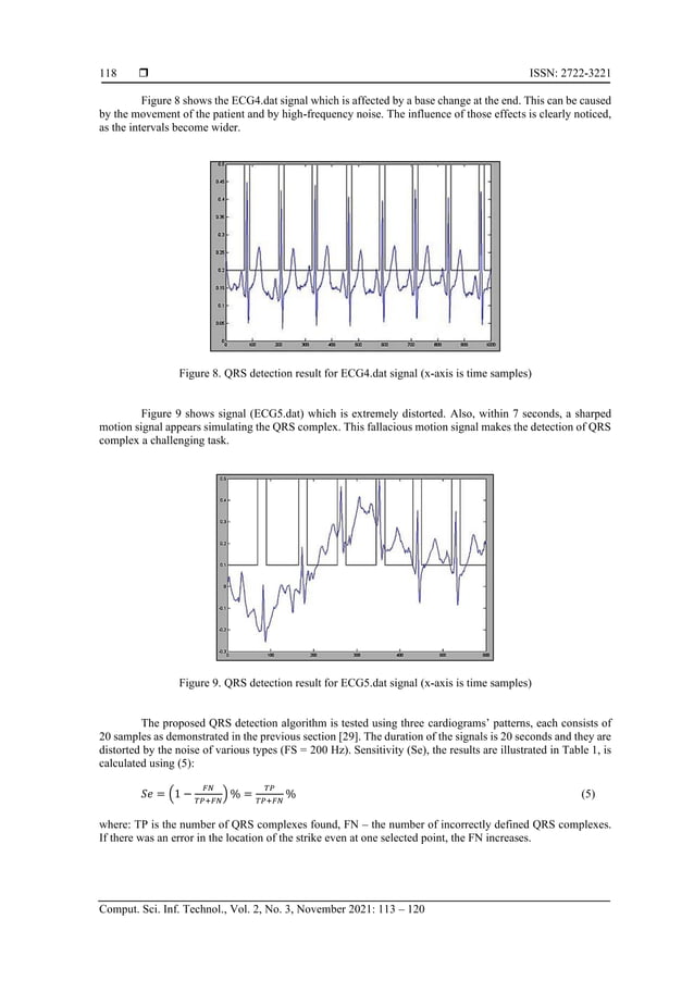 Less computational approach to detect QRS complexes in ECG rhythms | PDF